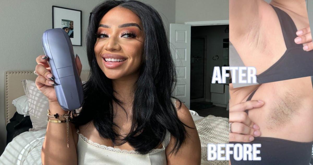 Ulike Air 10 Ipl Hair Removal Test My Before And After